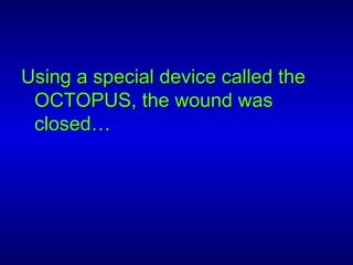 Stab injury to the heart | PPT