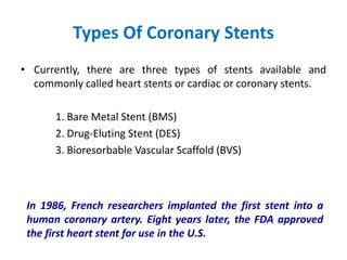 Cardiac Stent,valve,heart, disease, heart failure | PPTX