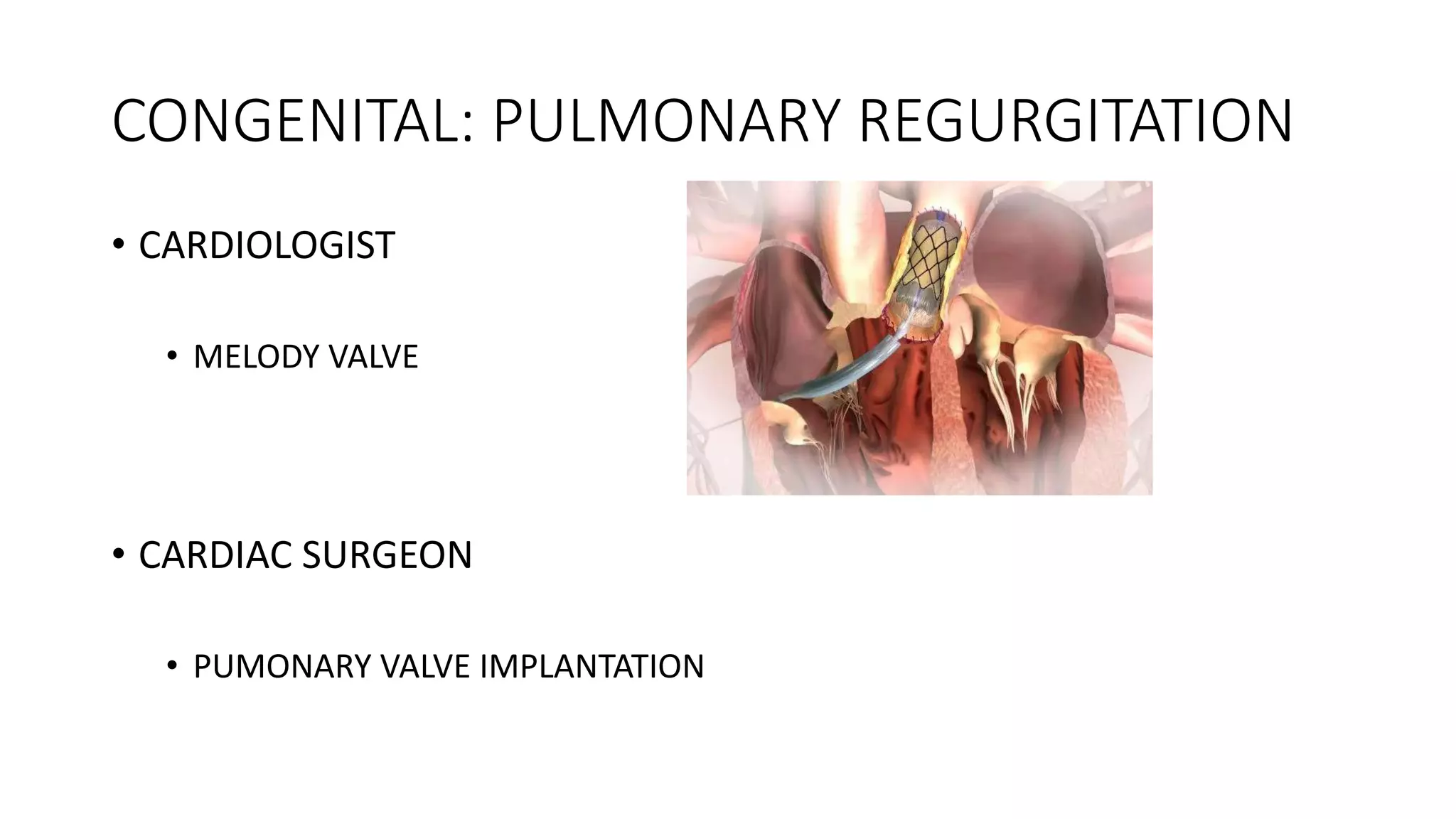 Cardiac surgeon vs cardiologist role | PPTX