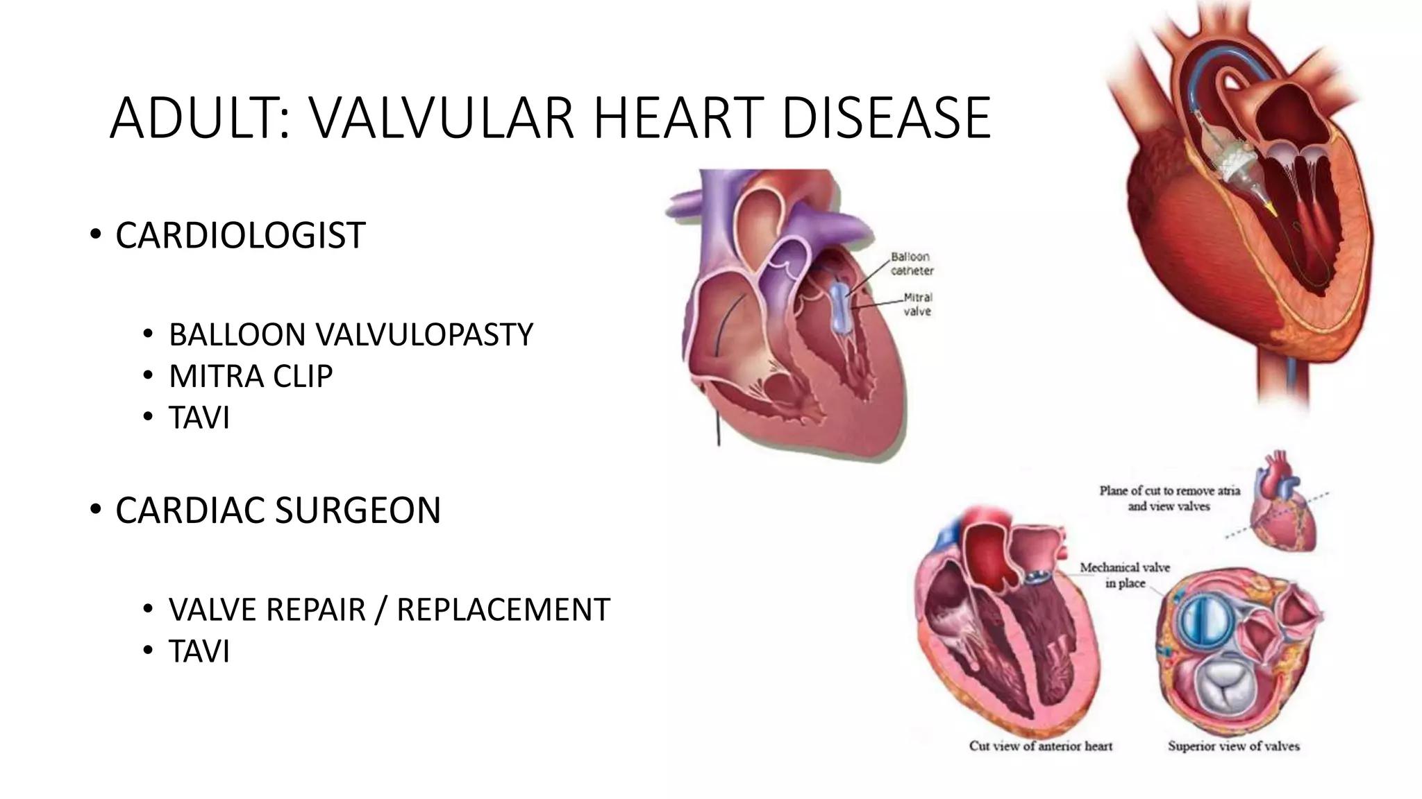 Cardiac surgeon vs cardiologist role | PPTX