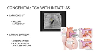 Cardiac surgeon vs cardiologist role | PPTX