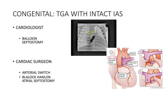 Cardiac surgeon vs cardiologist role | PPTX