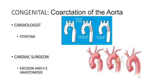 Cardiac surgeon vs cardiologist role | PPTX