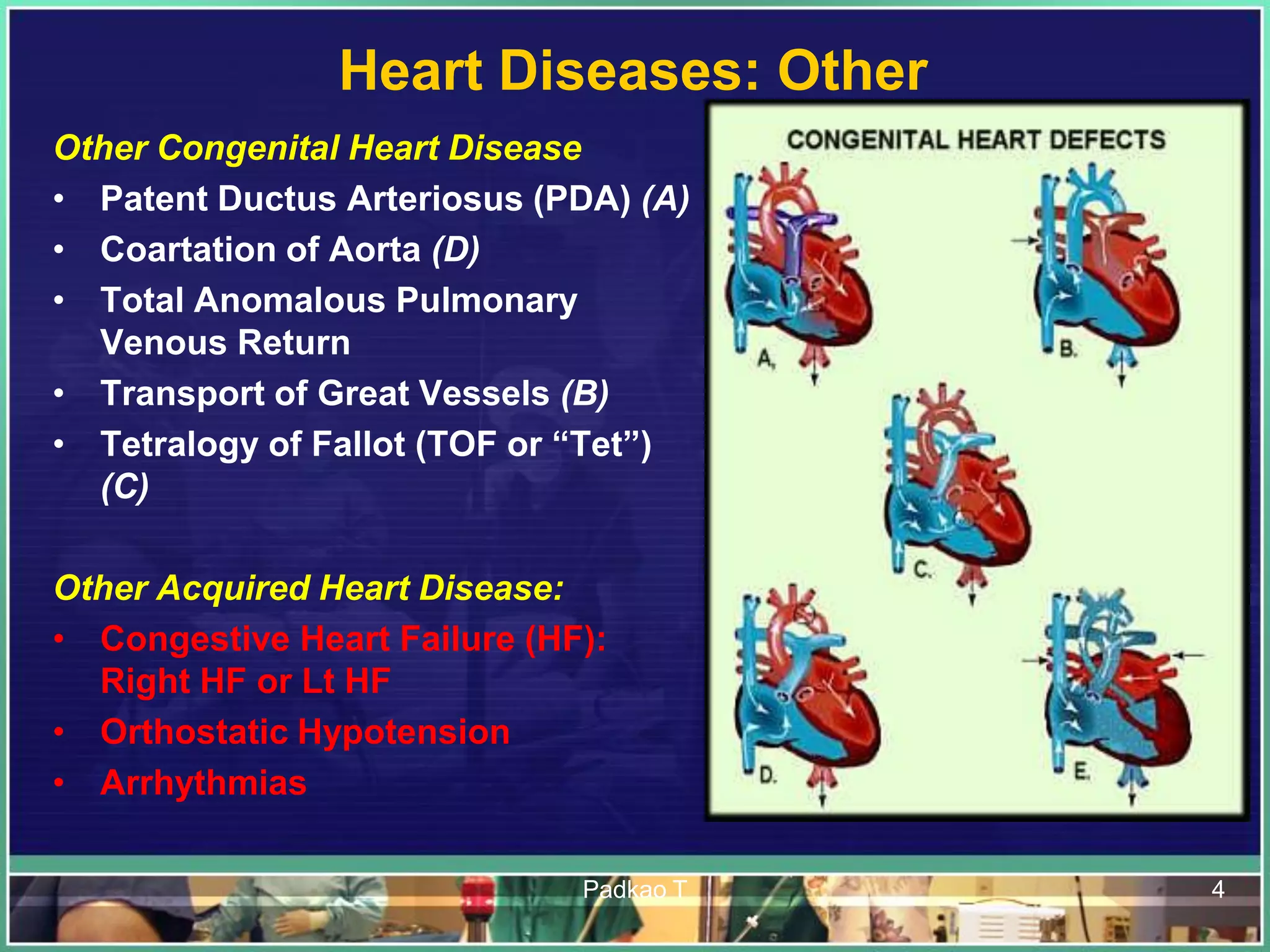 Cardiac surgeries_Padkao T | PDF