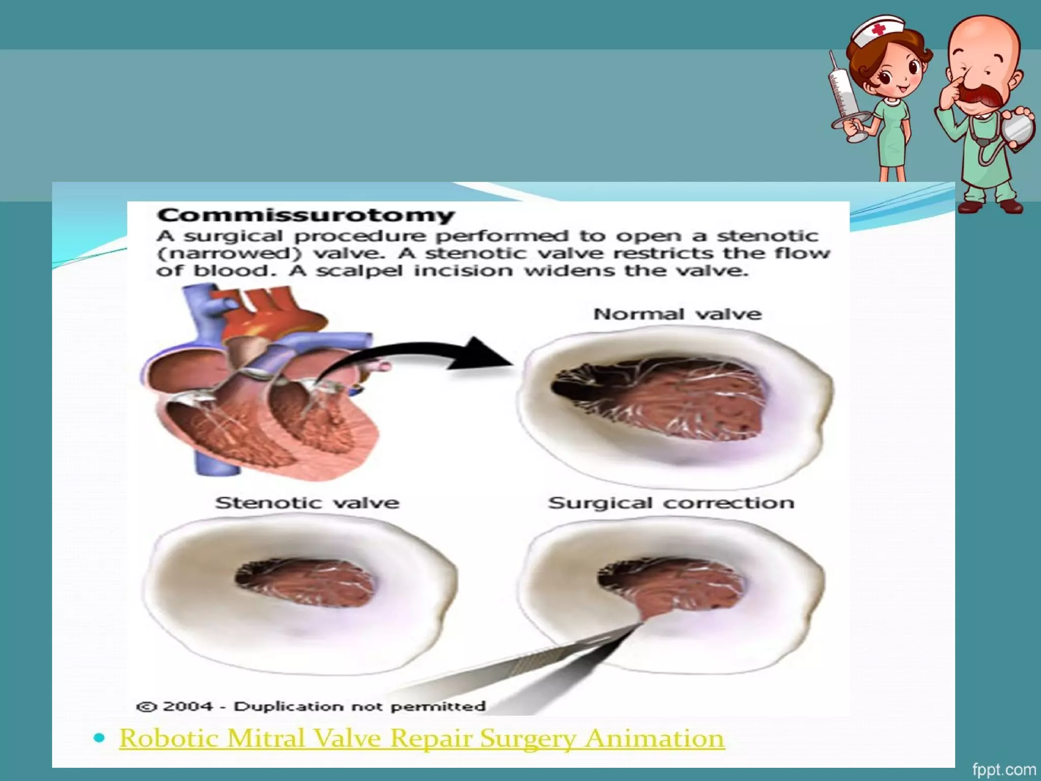 Cardiac surgeries | PPT