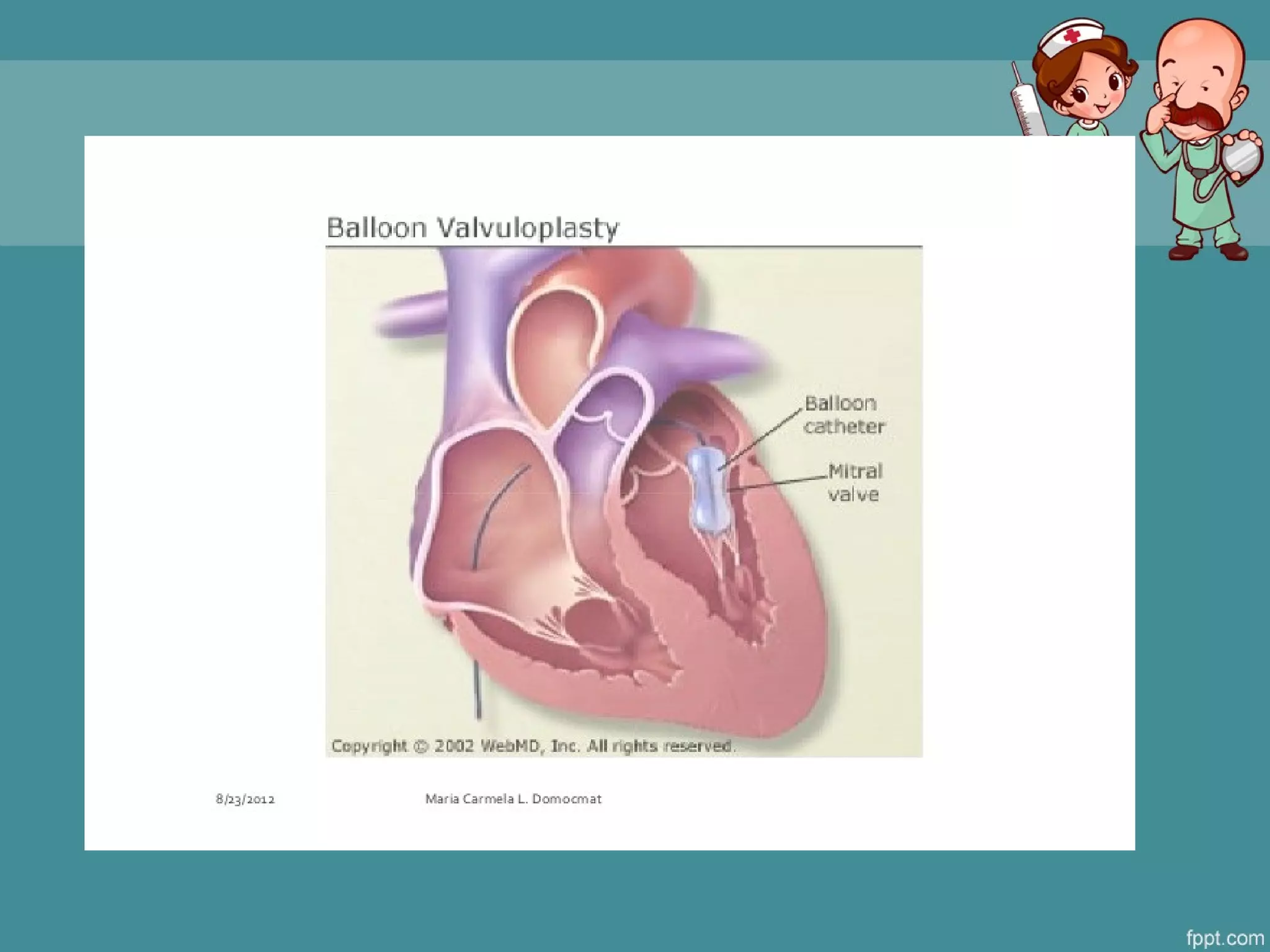 Cardiac surgeries | PPT