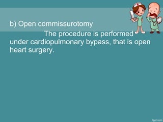 Cardiac surgeries | PPT