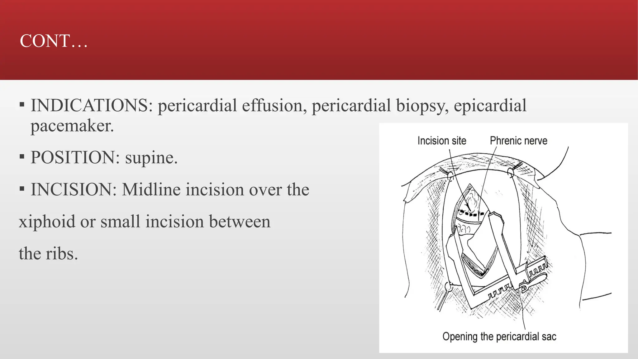 CARDIAC SURGERIES and its discription i detail | PPT | Free Download