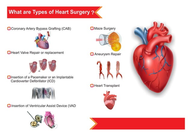 Types of heart surgery | PPT