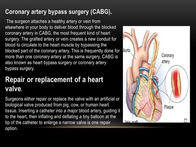 Cardiac Surgery.pptx