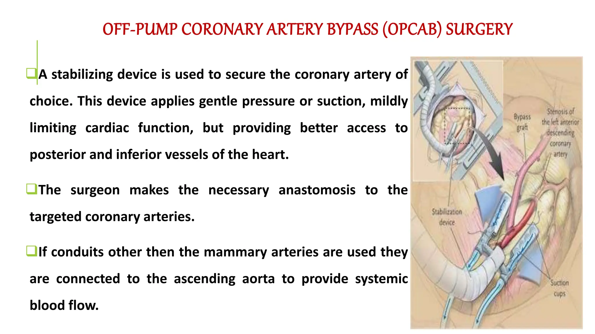 Cardiovascular surgeries-CABG,TYPES,CARDIOPULMONARY BYPASS MACHINE | PPTX