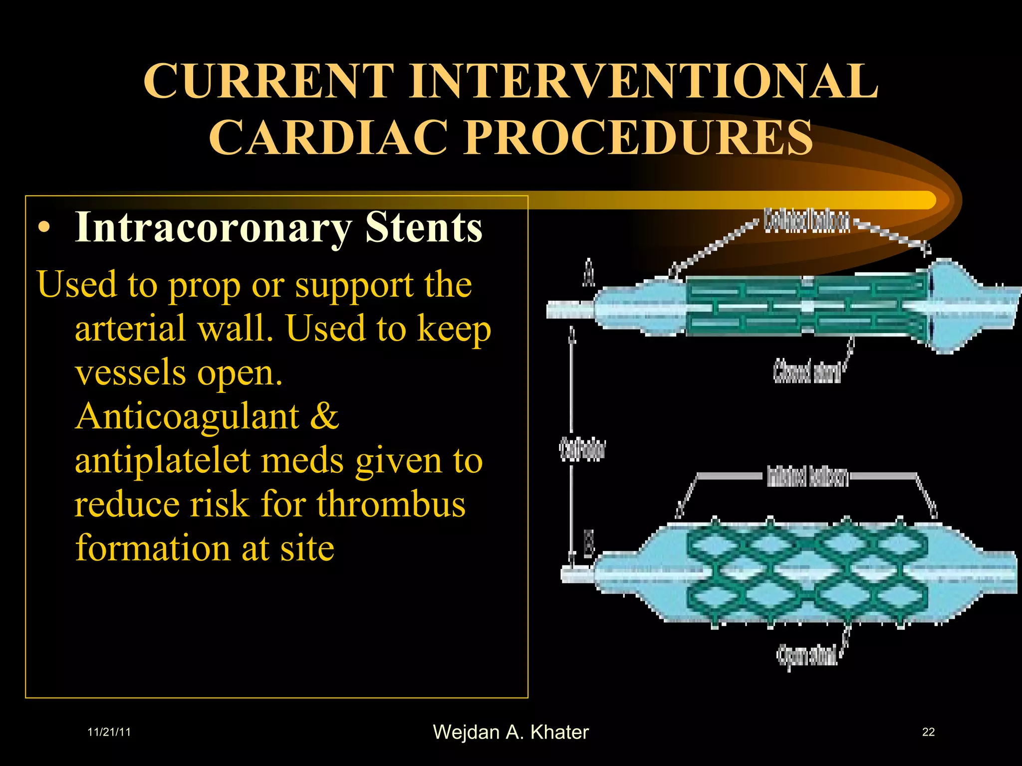 Cardiac surgery and ptca | PPT