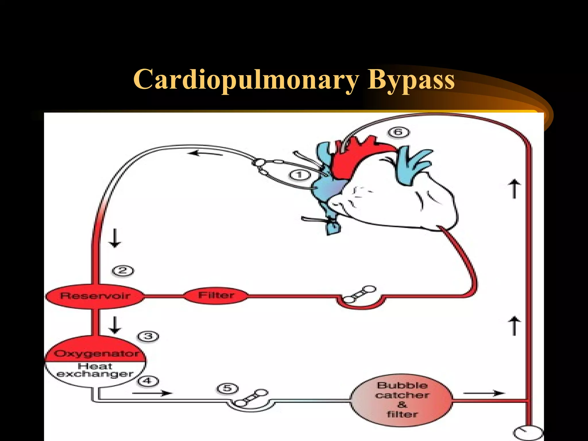 Cardiac surgery and ptca | PPT