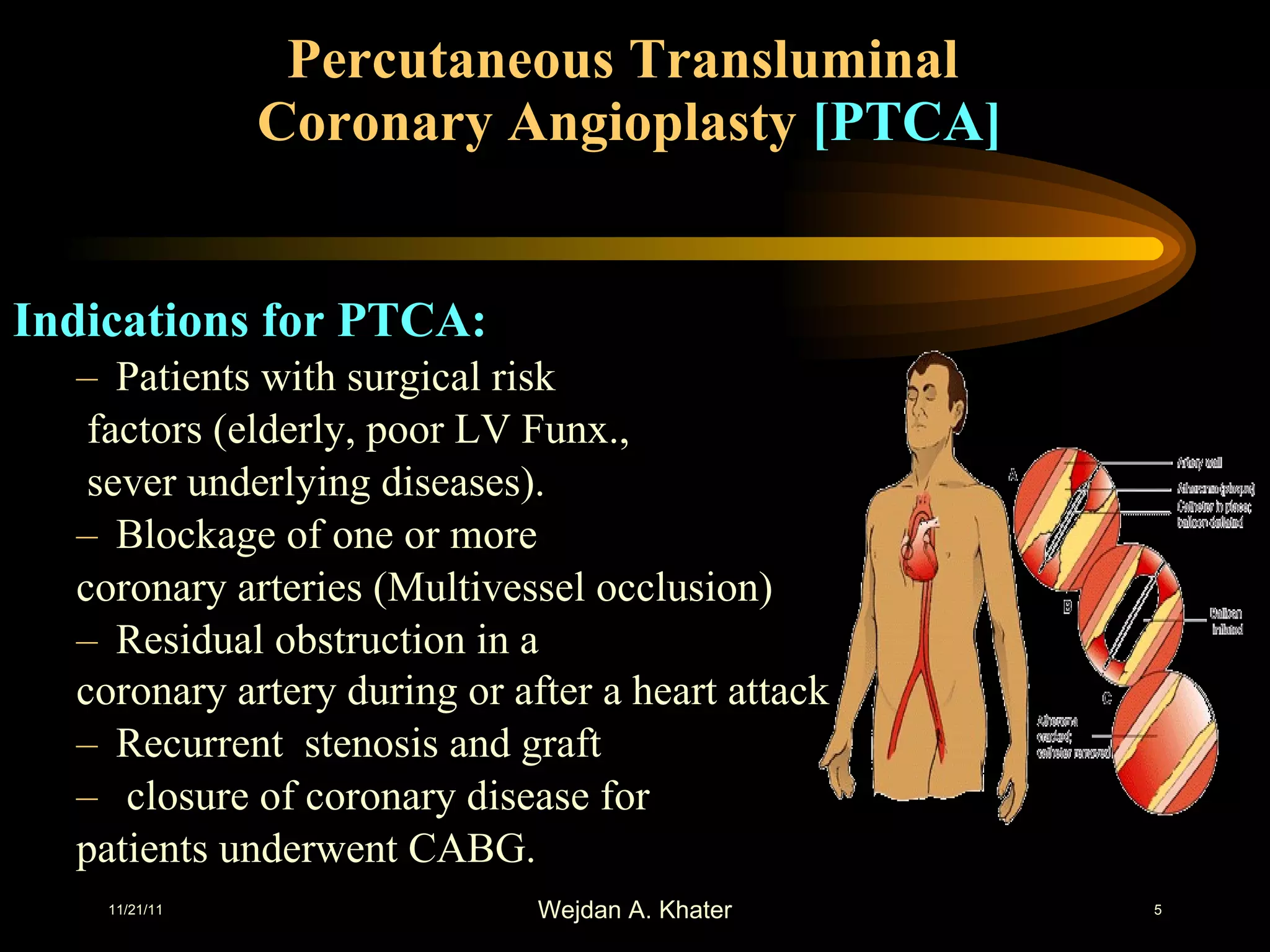 Cardiac surgery and ptca | PPT