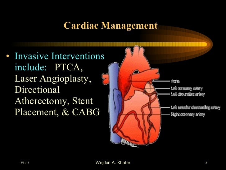 Cardiac surgery and ptca