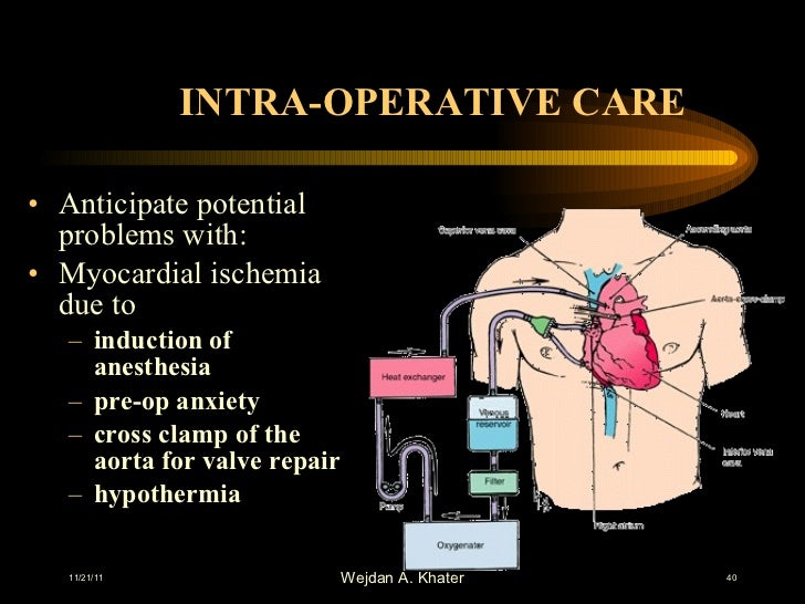 Cardiac surgery and ptca