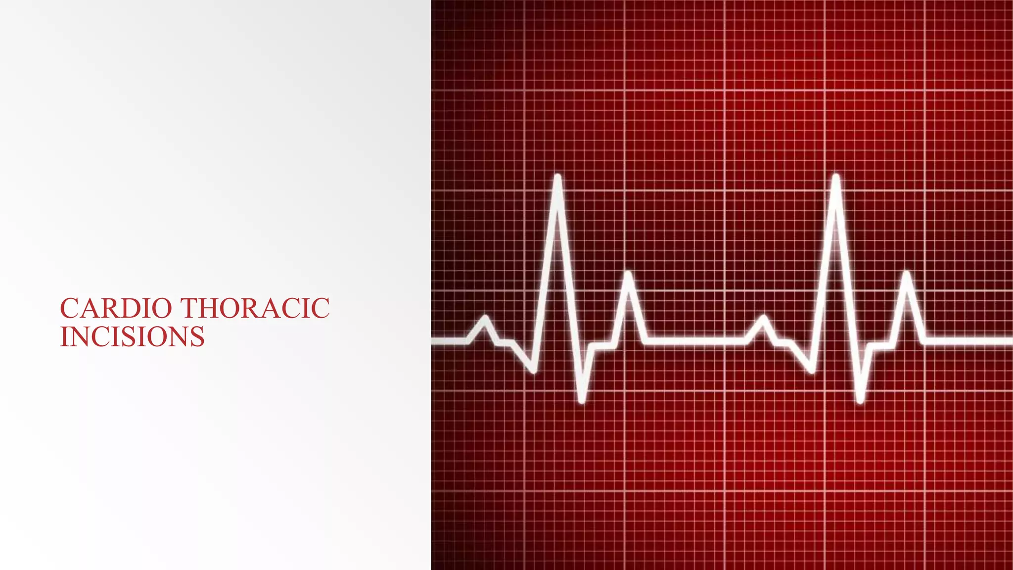 Cardiac surgery | PPTX