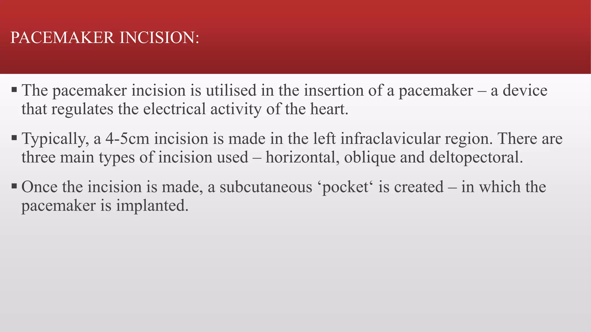 Cardiac surgery | PPTX