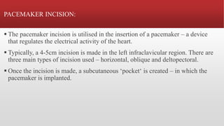 Cardiac surgery | PPTX