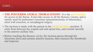 Cardiac surgery | PPTX