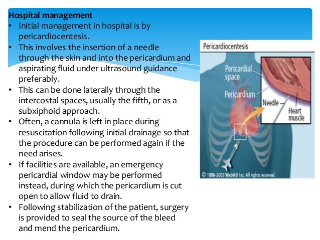 Cardiac tamponade-Pericardial Effusion...