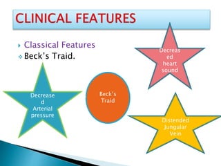 Cardiac tamponade | PPTX
