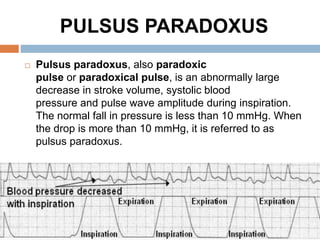 Cardiac tamponade BY PANKAJ | PPTX