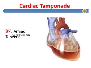 Cardiac tamponade | PPTX