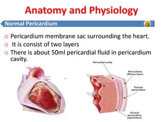 Cardiac tamponade | PPTX