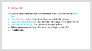 Cardiac tamponade | PPTX