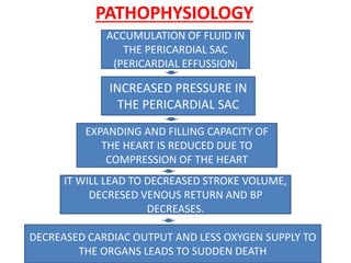 CARDIAC TAMPONADE | PPTX