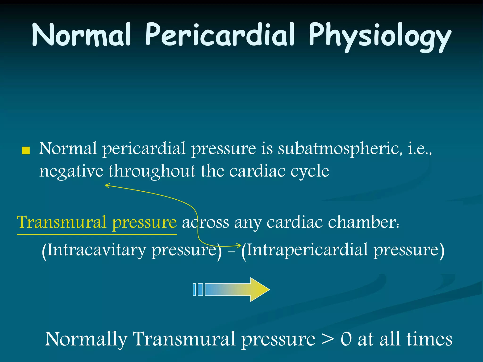 Cardiac tamponade | PPTX