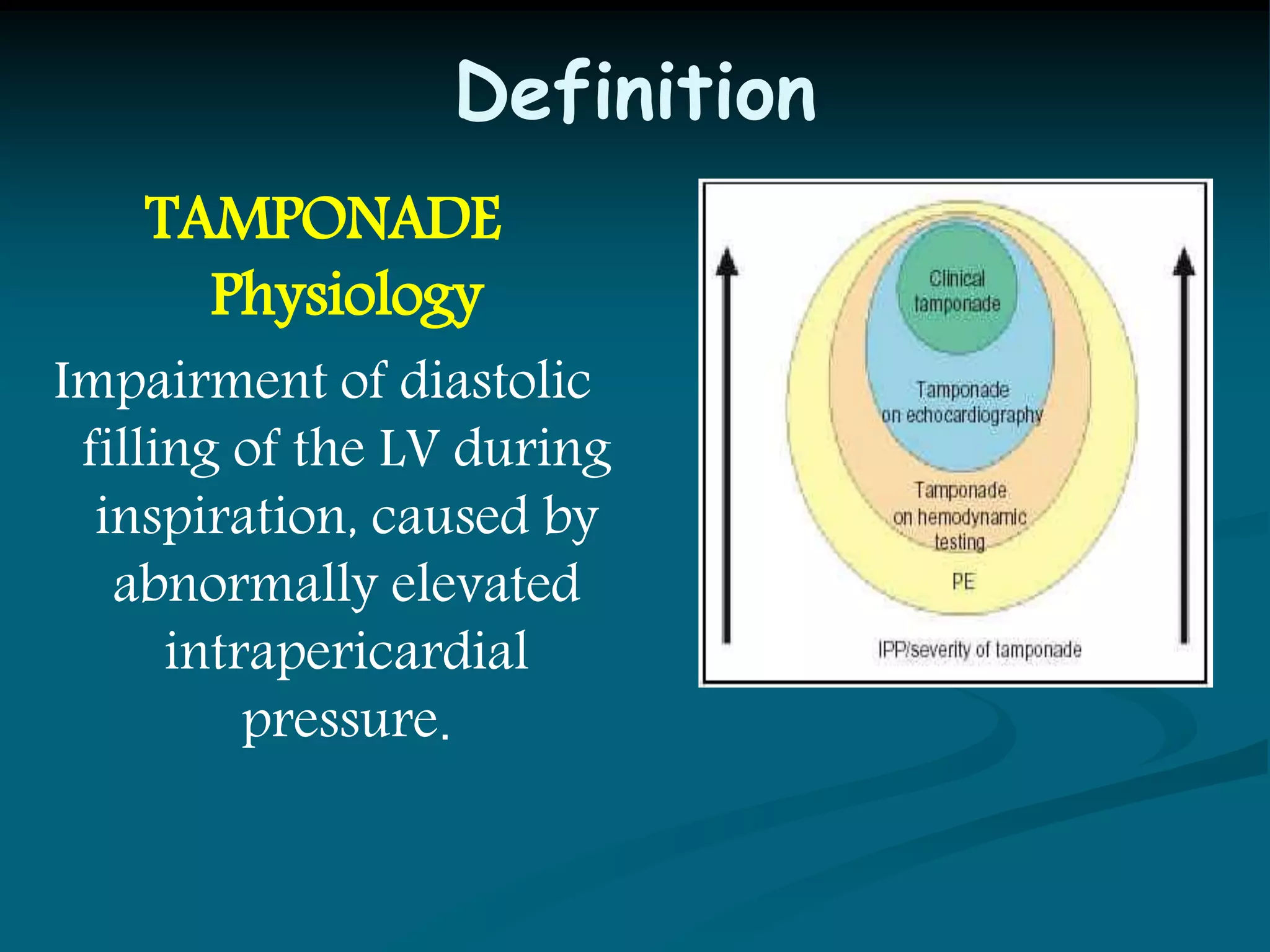Cardiac tamponade | PPTX