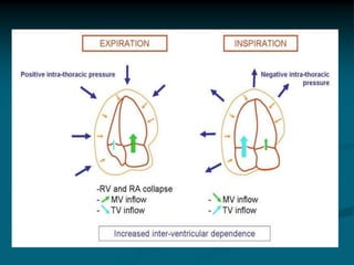 Cardiac tamponade | PPTX