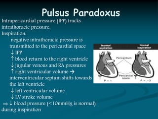 Cardiac tamponade | PPTX