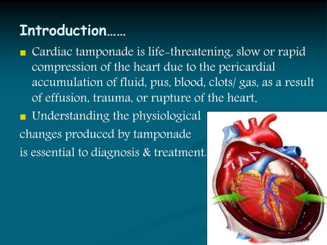 Cardiac tamponade | PPT