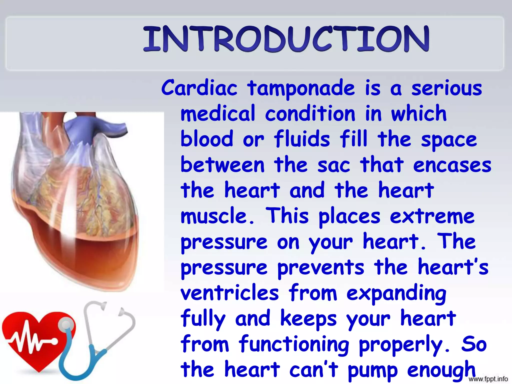 Cardiac tamponade | PPTX