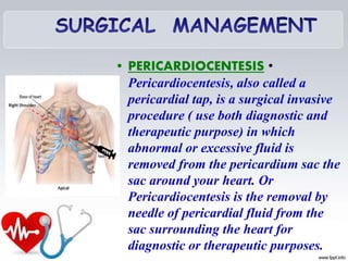 Cardiac tamponade | PPTX