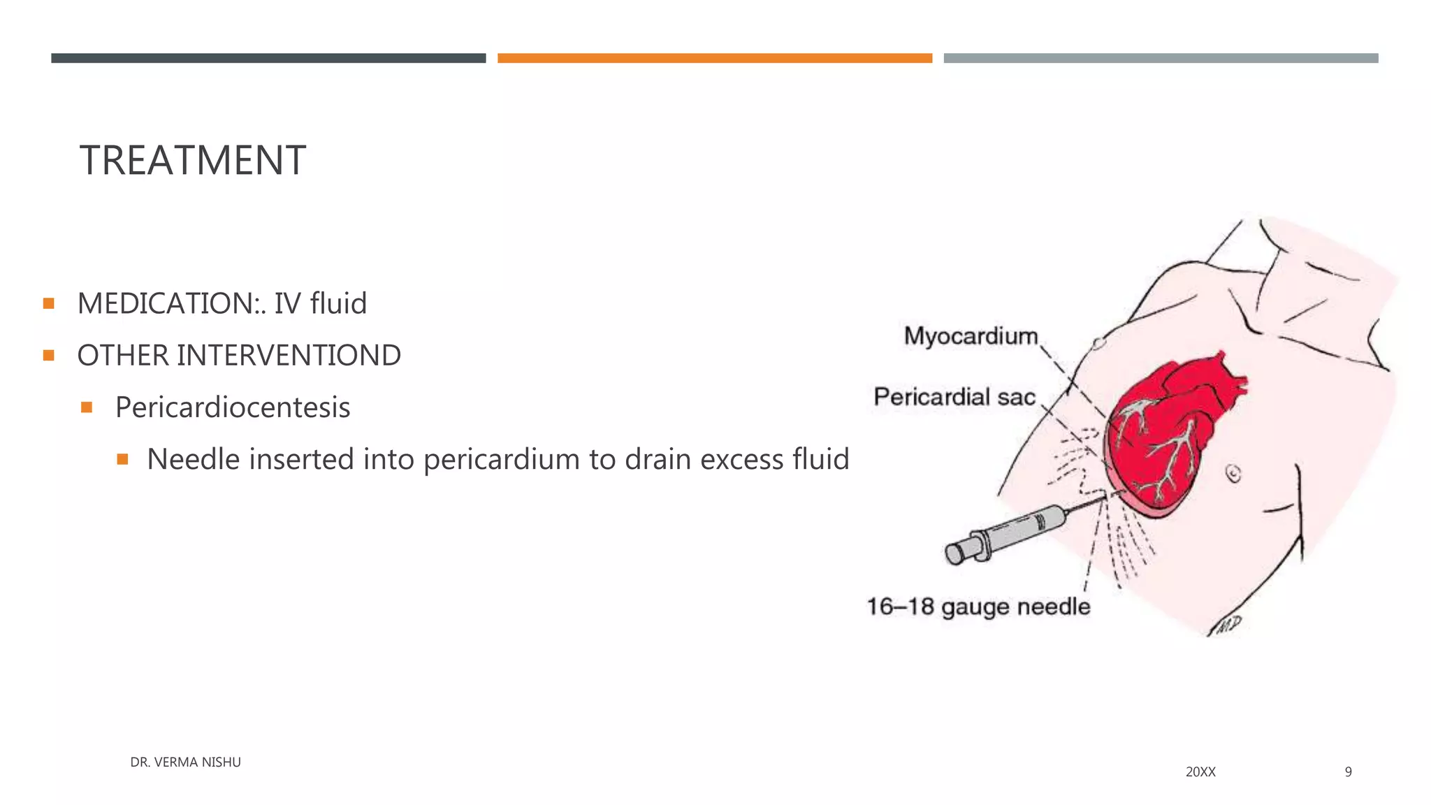 Cardiac tamponade | PPTX