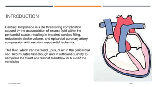 Cardiac tamponade | PPTX