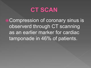 Cardiac tamponade | PPTX