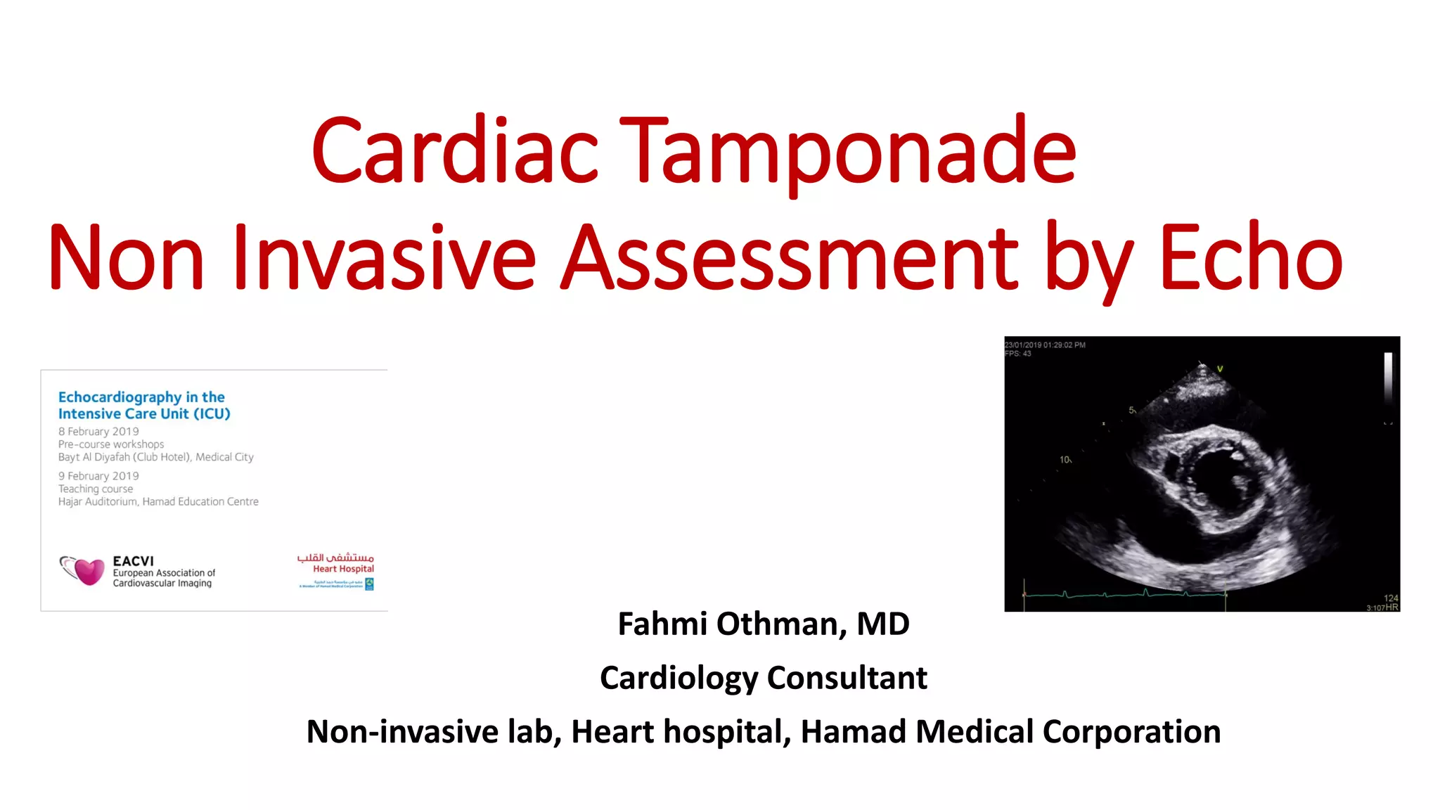 Cardiac Tamponade.pdf
