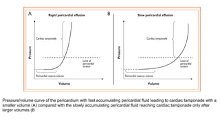 Cardiac Tamponade.pdf