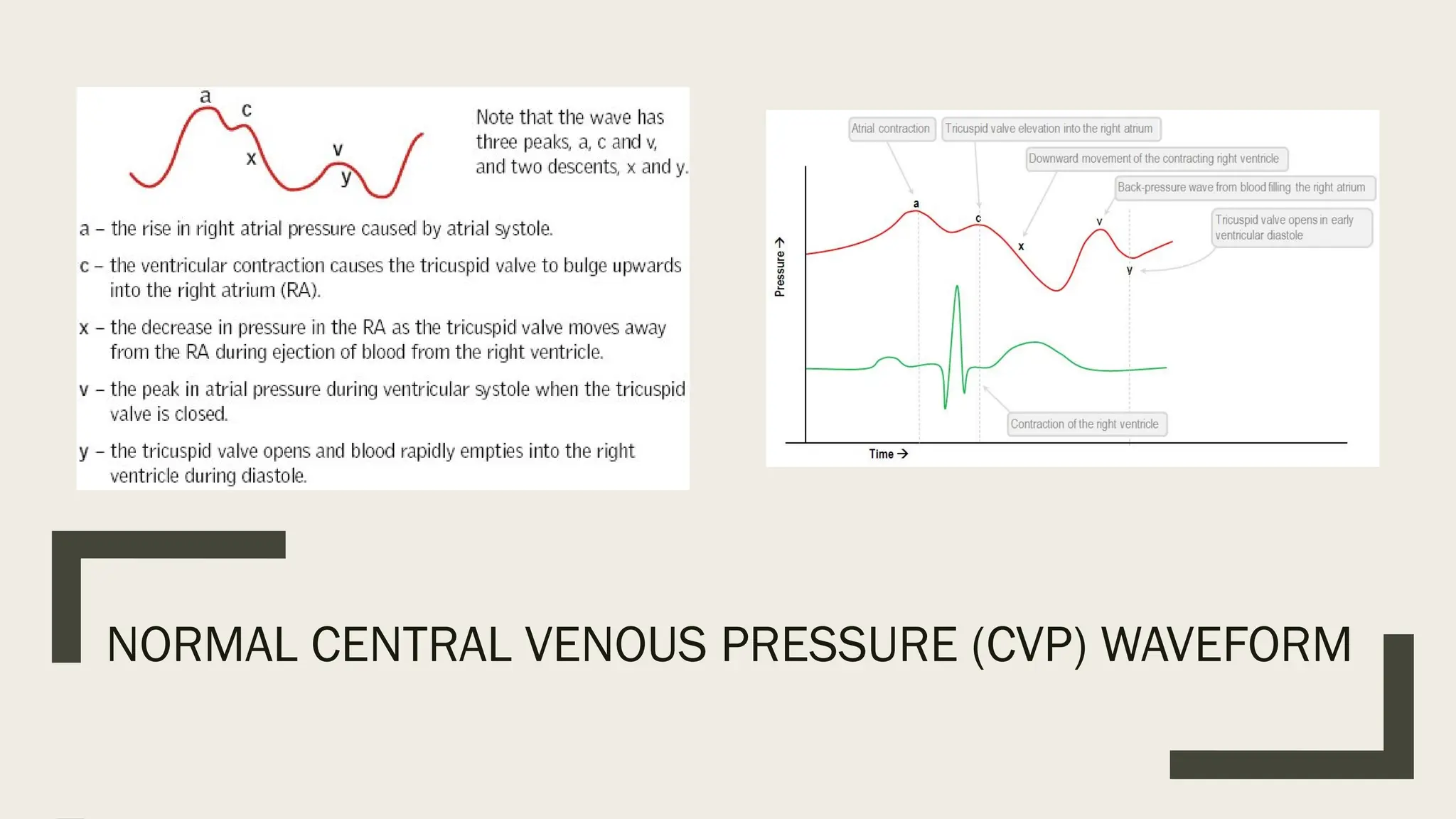 cardiac tamponade for nursing specialist.pptx