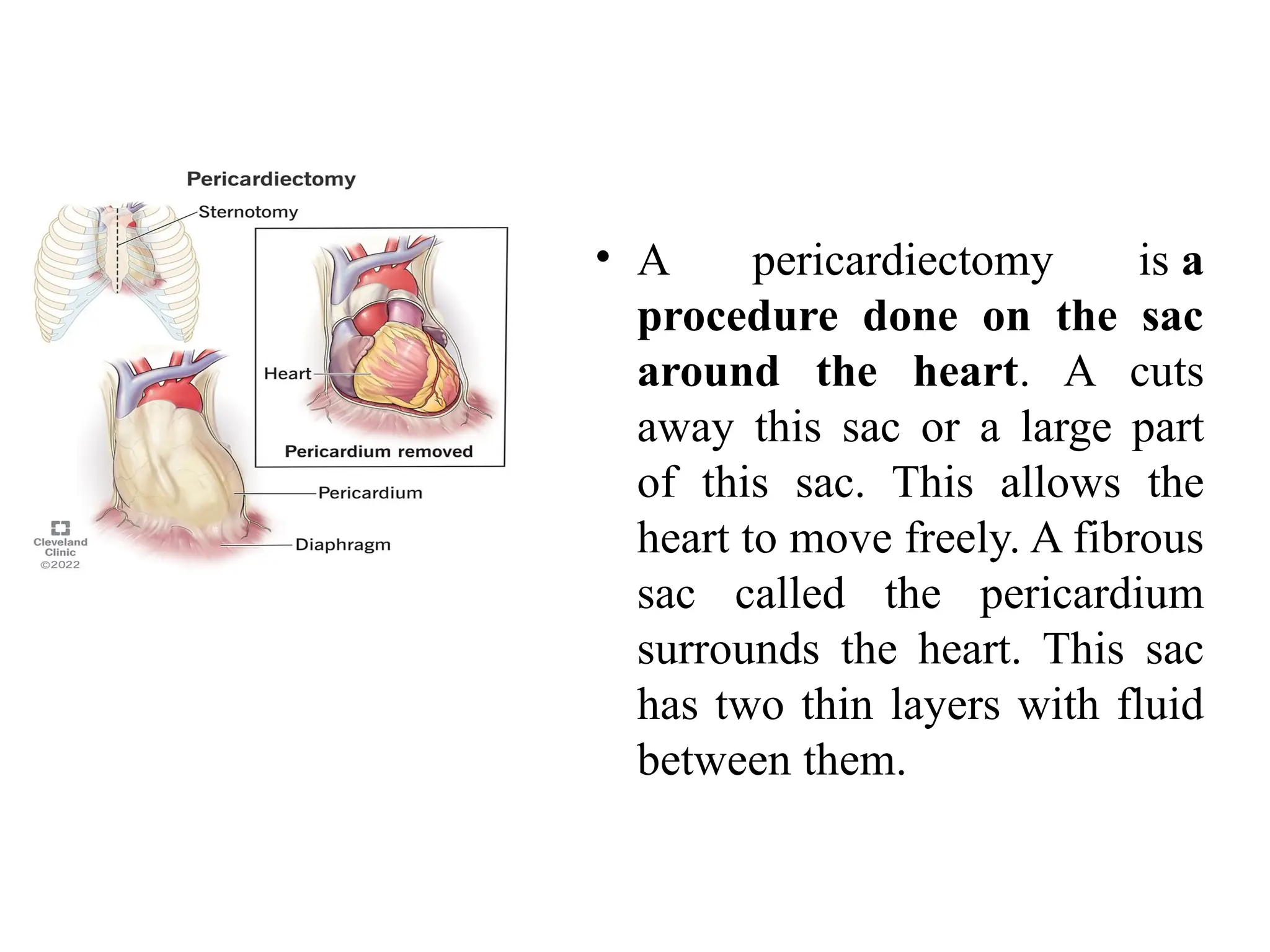 cardiac tamponade.heart disease which affects outer and inner | PPTX