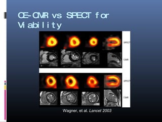 Cardiac Testing for the Layman | PPT