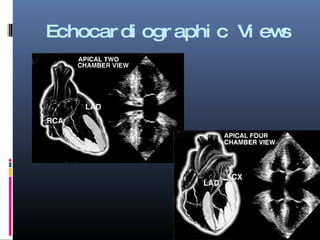 Cardiac Testing for the Layman | PPT