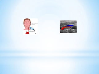 Cardiac testing procedures (1) | PPT