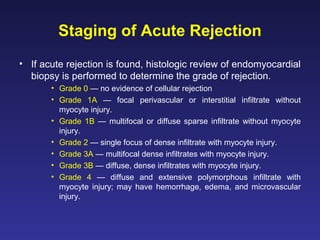 Cardiac Transplantation | PPT