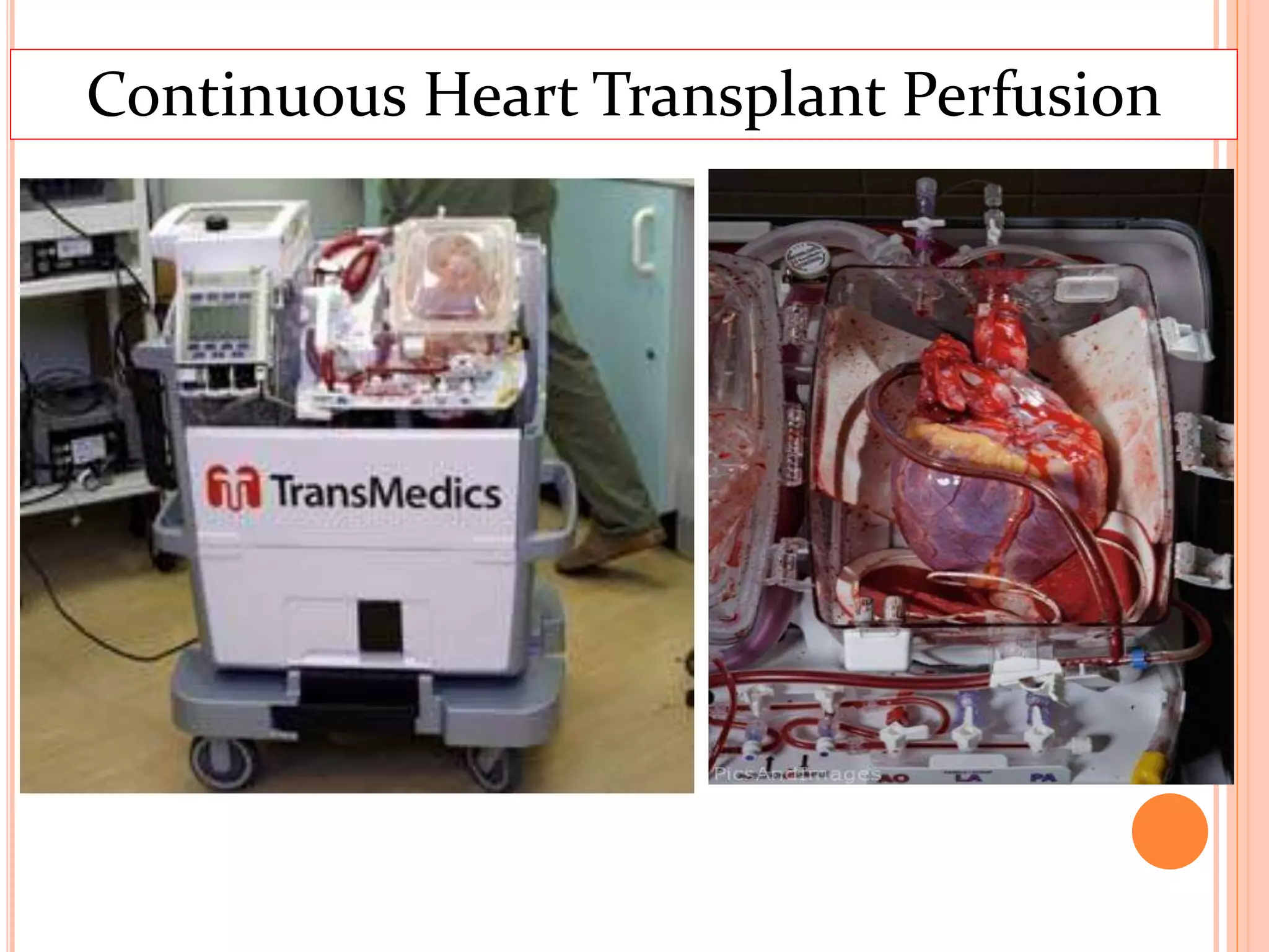 cardiactransplantation-150201093806-conversion-gate02.pdf
